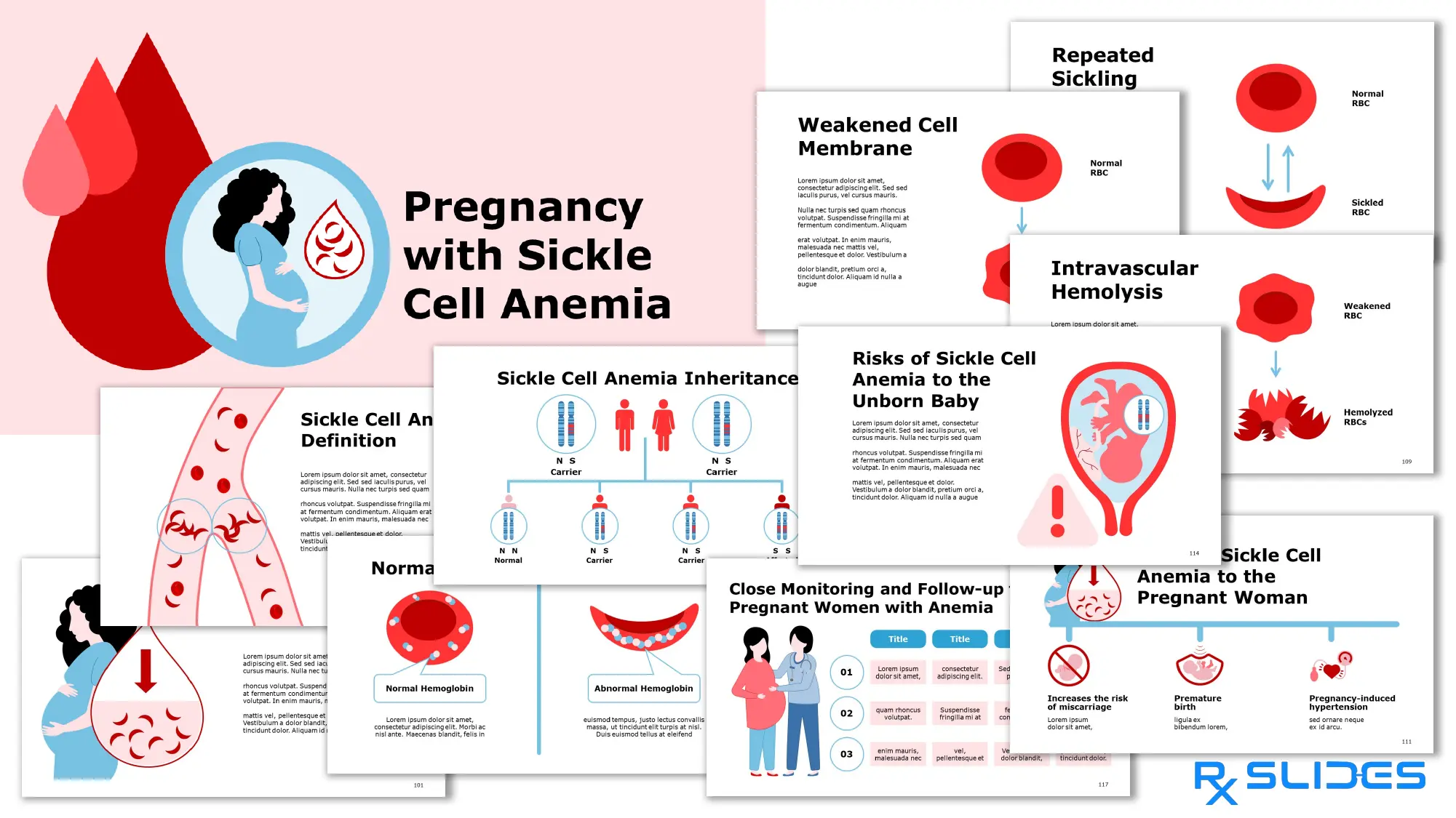 Download Anemia in Pregnancy PPT Template| RxSlides